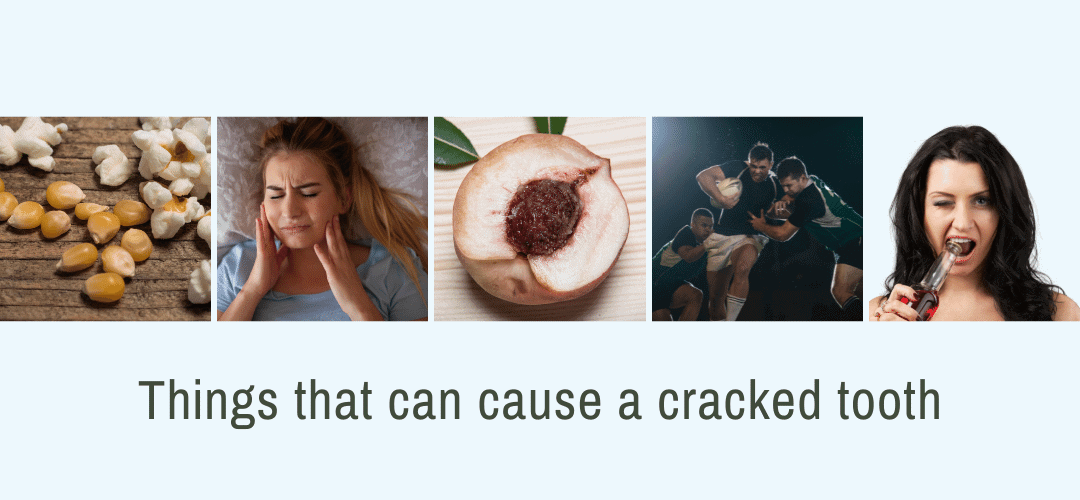 Do You Need Dental Treatment For A Cracked Tooth? - Your Healthy Smile